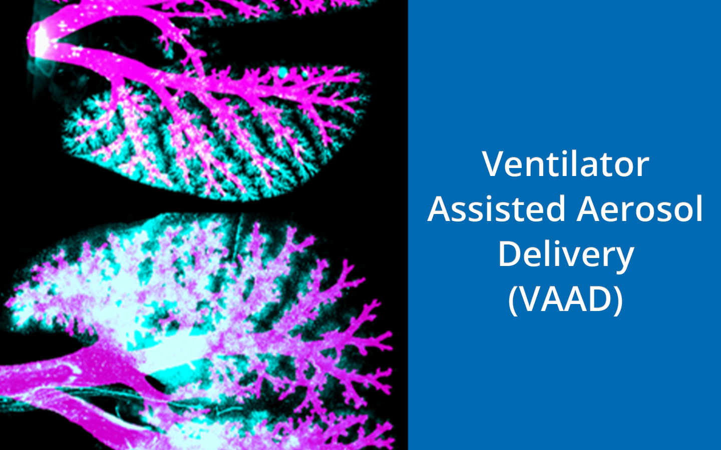 Ventilator Assisted Aerosol Delivery (VAAD) - SCIREQ